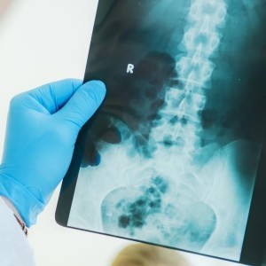 RX Coluna lombo-Sacra Funcional ou dinâmica 7 Incidências em Porto ...